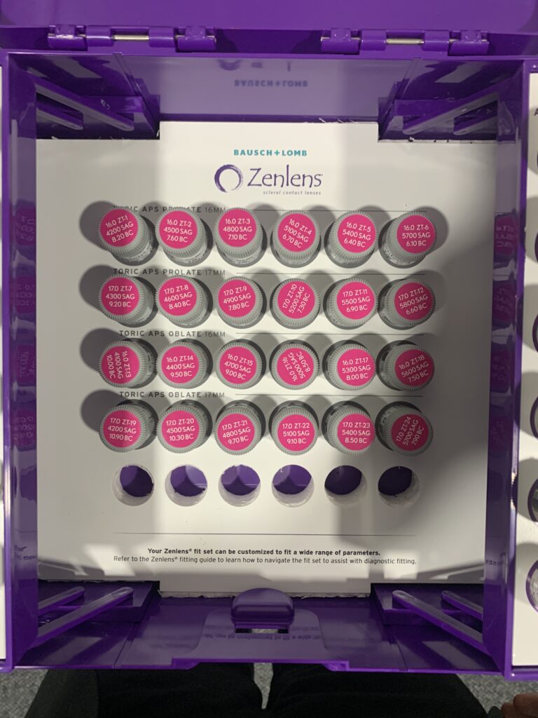 What To Expect During Your Scleral Lens Fitting Visit