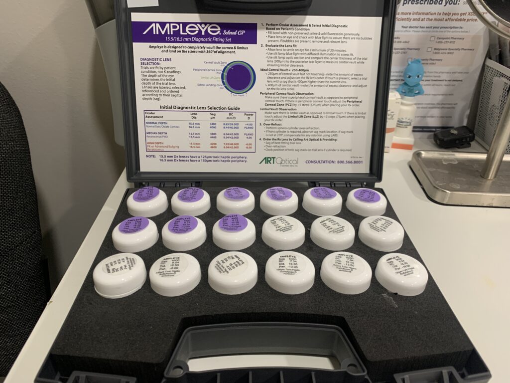 Finding The Best Scleral Lens Exam In Michigan | Michigan Contact Lens
